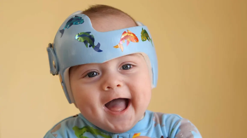 Play at Home Physical Therapy - Effective Plagiocephaly Treatment ...